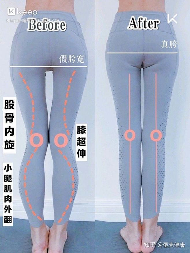 Xo型腿如何靠按摩或锻炼矫正？ 知乎 如何判断自己是哪种腿型？自然站直，将双腿并拢，观察两腿间的线条。 简单腿型小自测