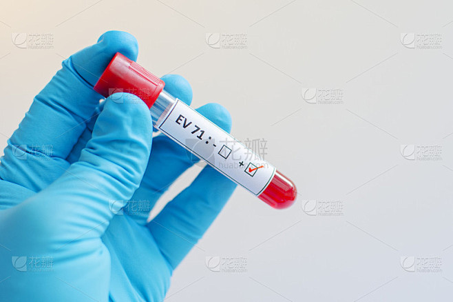 肠病毒71型(ev71型，手足口病)