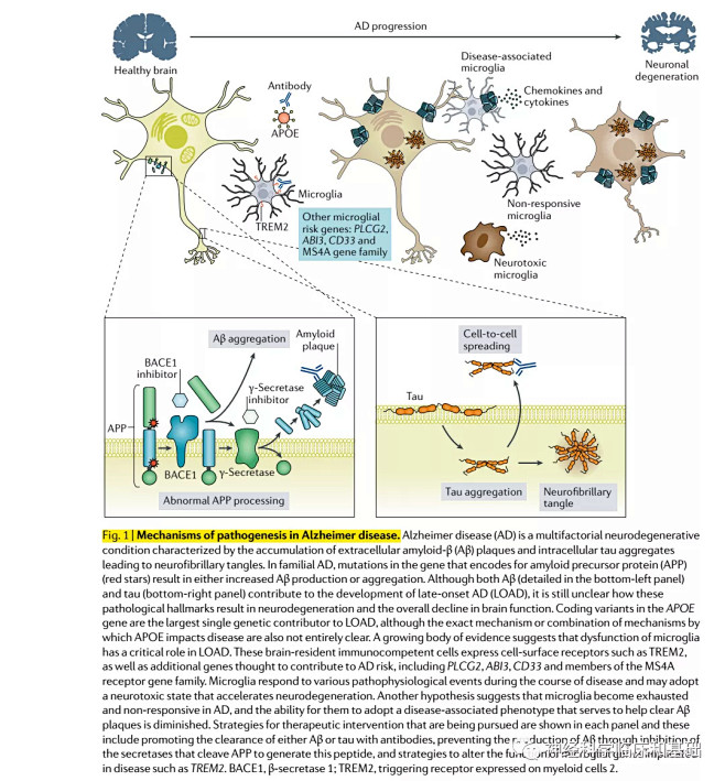 Nat Rev Drug Discov—这是阿尔茨海默病疾病模型的最新研究进展，本质上近20年没有太大进展，急需突破！！ : 2019年十大研究进展名录1. 年终盘点：2019年帕金森病十大 ...