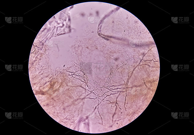 皮肤真菌显微镜观察，指甲刮拭真菌检查