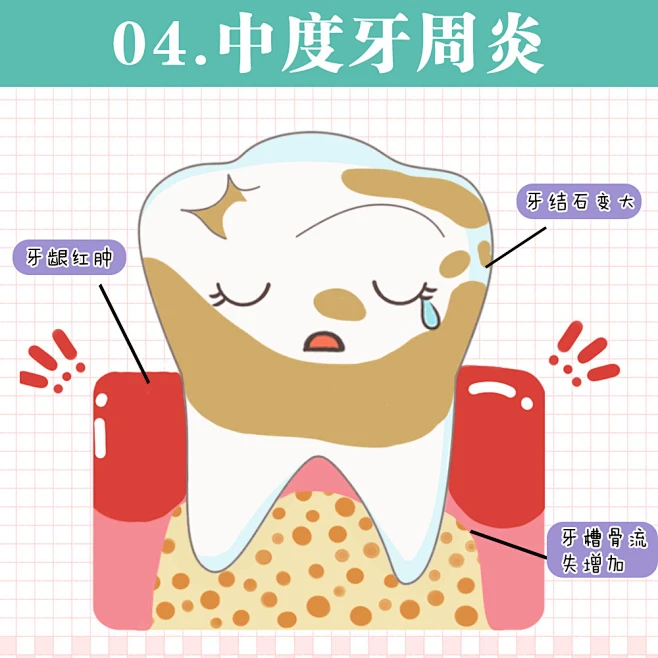 牙周炎等级_刘玉美_【68Design】-花瓣网