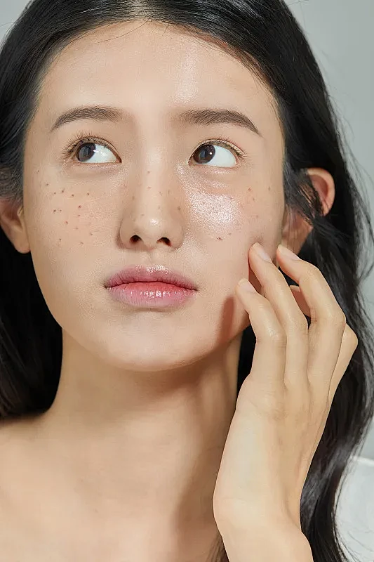 女性，皮肤，雀斑，烦恼正版高清图片下载-视觉中国VCG.COM-花瓣网