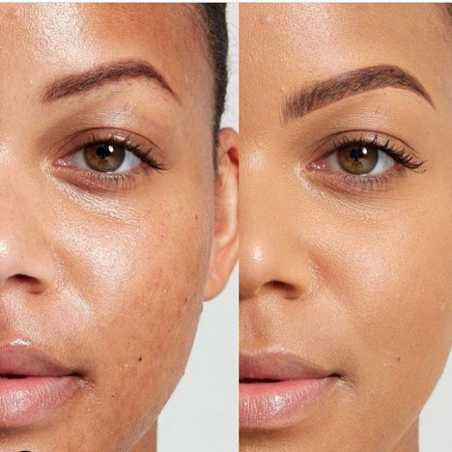 PRIMA / DOPO. Questo fondotinta liquido si fonde con la pelle come per ...