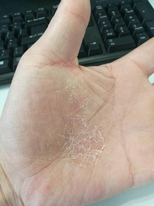 手部干燥的搜索结果_百度图片搜索-花瓣网