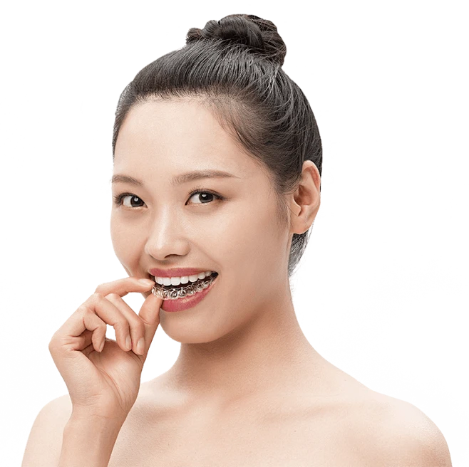 Smartee GE正雅经典版-定制式牙齿隐形正畸矫治器-3D隐形矫正-隐形牙套优势-Smartee正雅-花瓣网