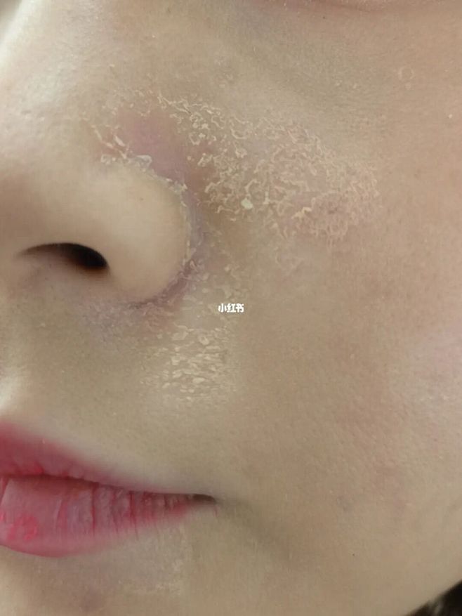 【办公室急救补妆】卡粉卡到妈不认怎么办 天天化妆上班，通勤上班，每天都是带妆10 12个小时的状态。本来我就是个大干皮，在办公室长期开空调，非常干燥，经常到了午休时间就严重卡粉起皮。大家