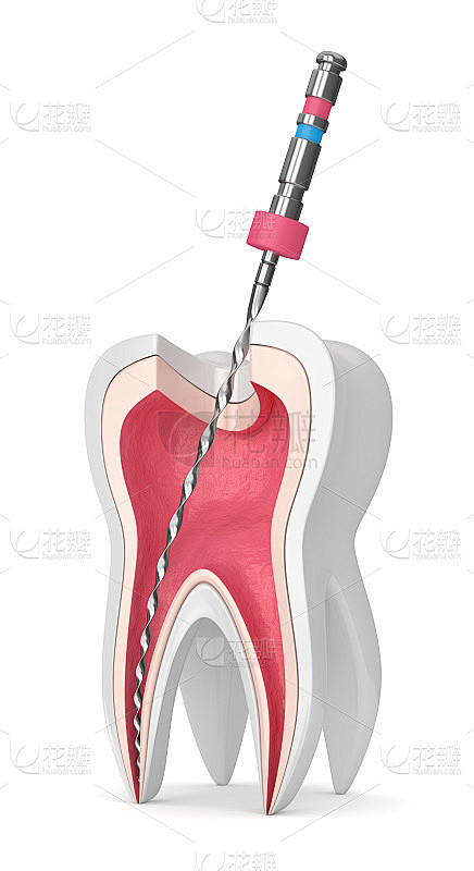 3d渲染的牙齿与根管锉