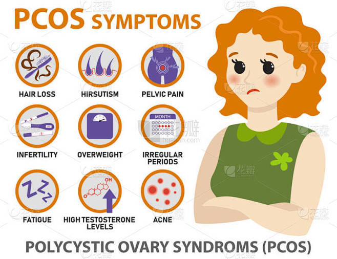 Pcos 信息图的症状。详细的矢量信息图.
