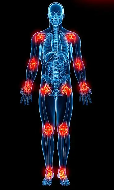 joint pain, computer artwork. - full body joints 幅插畫檔、美工圖案、卡通及圖標-花瓣网
