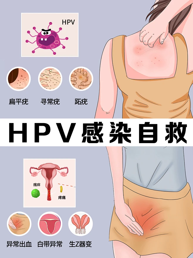 HPV自测2-花瓣网