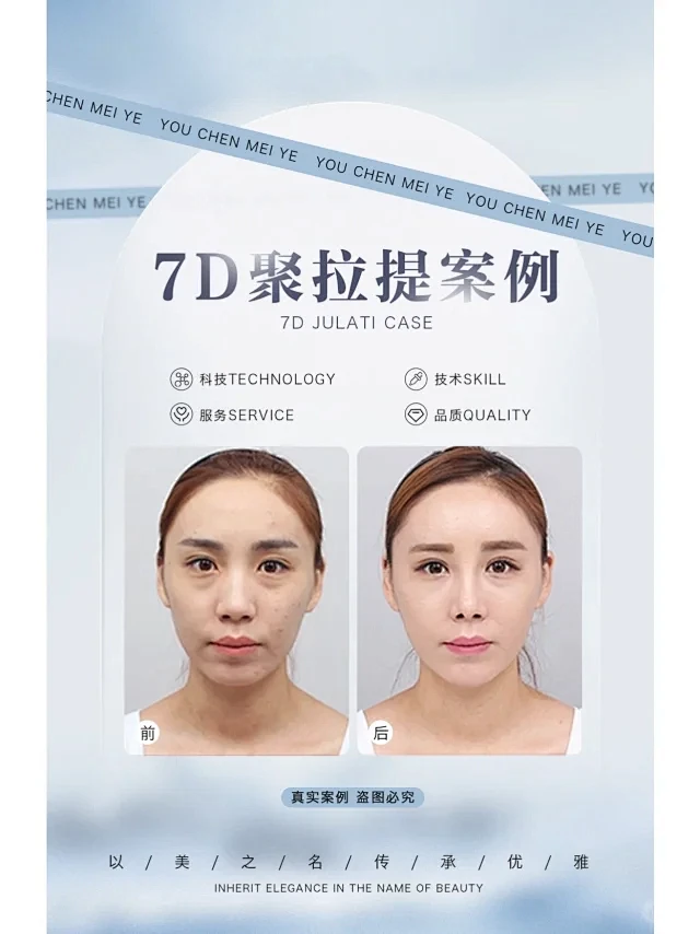 医美对比图海报 - 小红书搜索-花瓣网