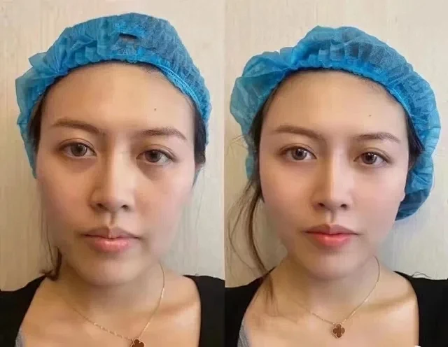 美业案例对比图 - 小红书搜索-花瓣网