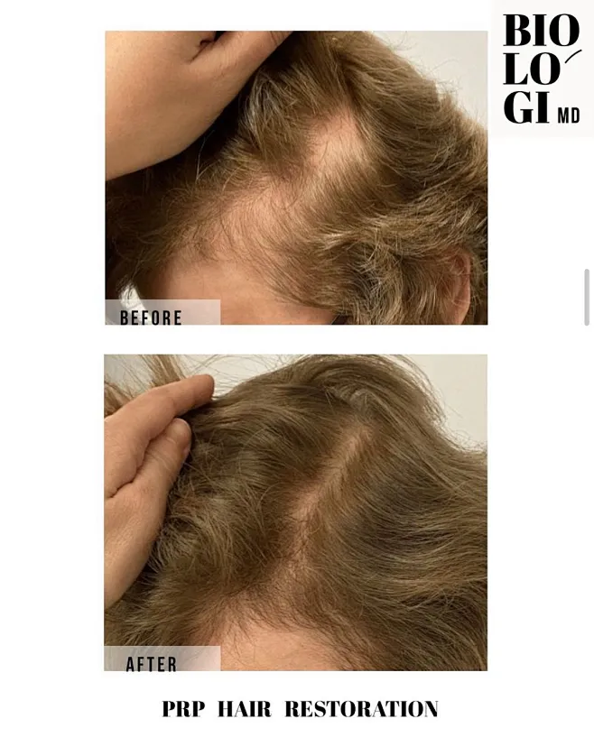 Photo by Biologi Med spa Orange County in Newport Beach, California ...