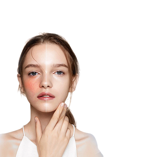 敏感肌 – remove.bg