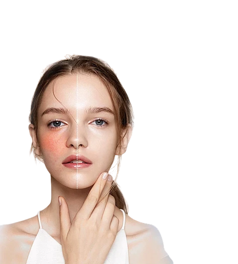 敏感肌 – remove.bg-花瓣网