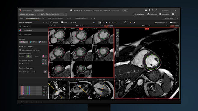 Philips IntelliSpace Portal Card