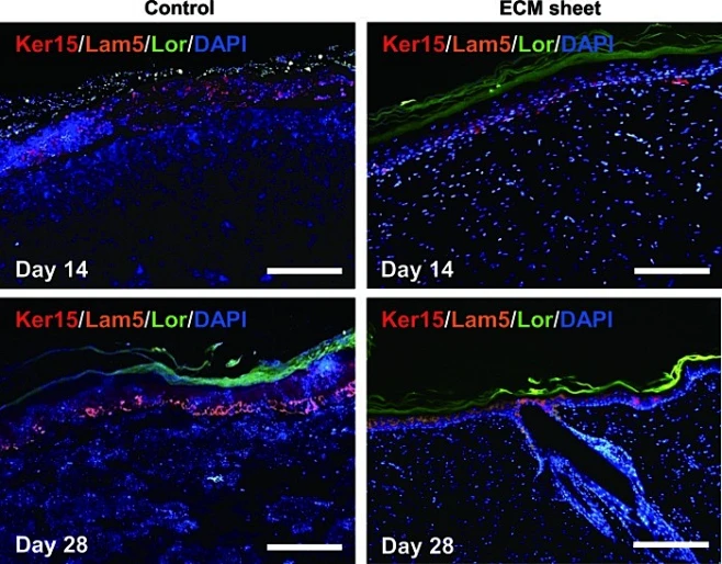 Full-Thickness Skin Wound Healing Using Human Placenta-Derived ...