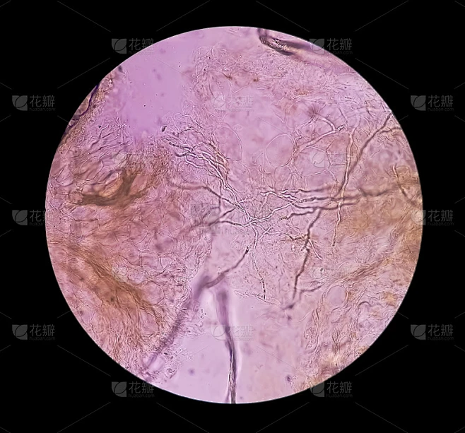 皮肤真菌显微镜观察，指甲刮拭真菌检查素材-花瓣网