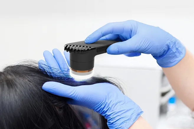 Scalp Camera Design | smallmark | 제품디자인 Product Design-花瓣网