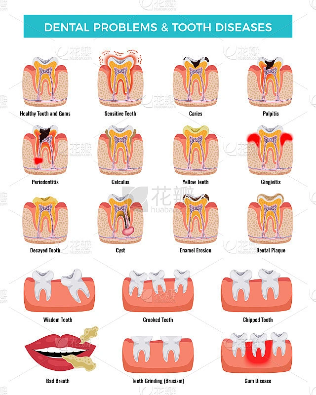 1912. i003.009.p.m005.c33。牙齿疾病，牙齿问题素材-花瓣网