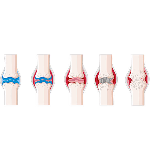 骨头关节-觅元素
