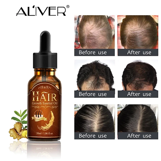 ALIVER Hair Growth Essence Hair Loss Liquid Natural Pure Origina ...