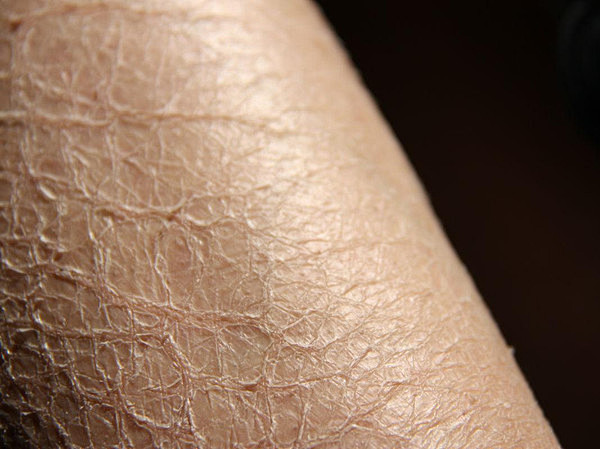 干燥肌肤的 搜索结果_360图片