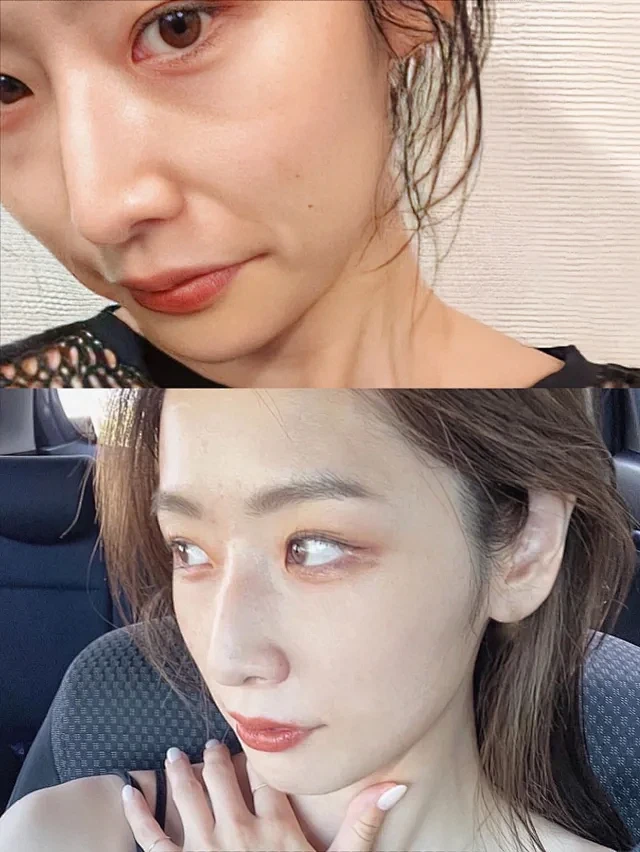 去法令纹对比图 - 小红书搜索图片_法令纹图片素材-花瓣网