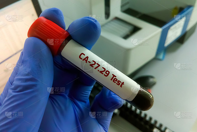 生化学家保存血液样本用于CA-27.29检测，诊断乳腺癌。