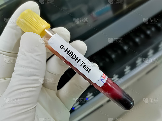 血液标本进行α-羟基丁酸脱氢酶(α-HBDH)检测，诊断心肌梗死