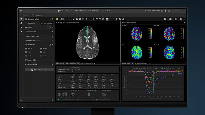 Philips IntelliSpace Portal MR_2806b6c5