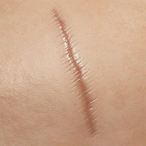 SkinGen: Liquid&Scar-花瓣网