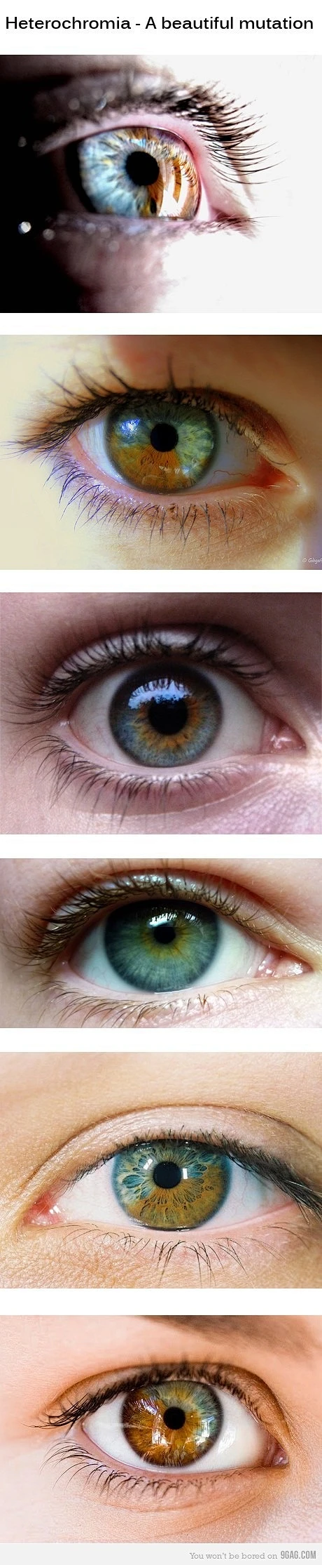 Heterochromia - a beautiful mutation of the iris. check out www.edacity ...