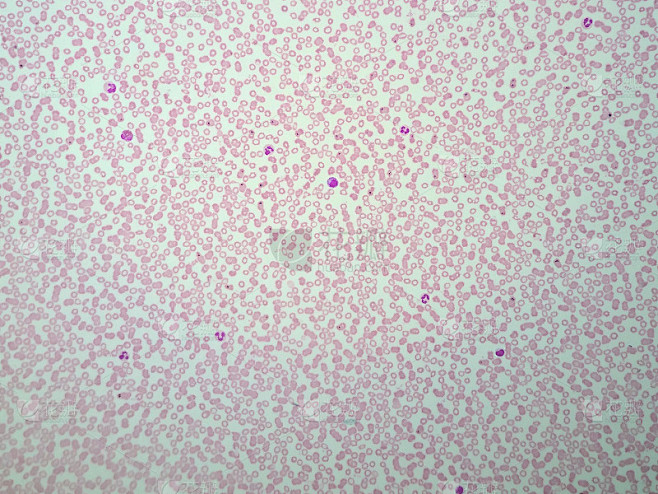 显微镜下的人类血细胞