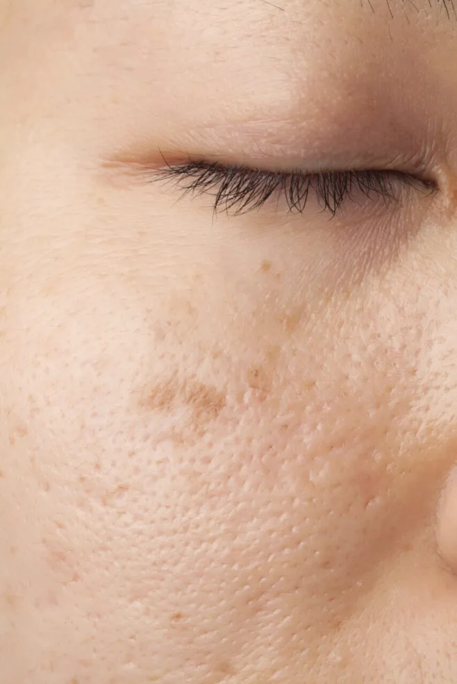 ThinkstockPhotos-187164144-花瓣网