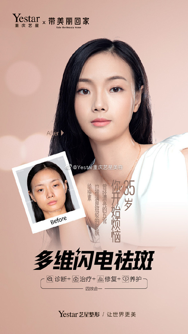 #净斑美肤 到艺星# 谁说祛斑是个持久战？ Yestar多维闪电祛斑 四效合一快速祛斑 祛斑速度实力派 让你自带滤镜 Yestar艺星整形丨让世界更美