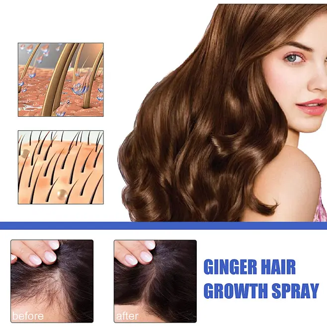 Eelhoe Ginger Hair Growth Spray Massage du cuir chevelu Nourrissant ...