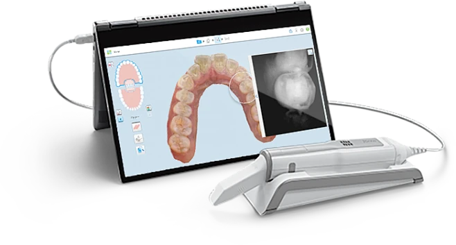 iTero Element 5D | iTero Intraoral Scanner-花瓣网