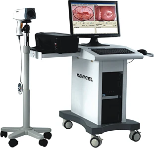 阴道镜|电子数码阴道镜|光学阴道镜|光电一体式阴道镜|科诺医学仪器设备有限公司-花瓣网