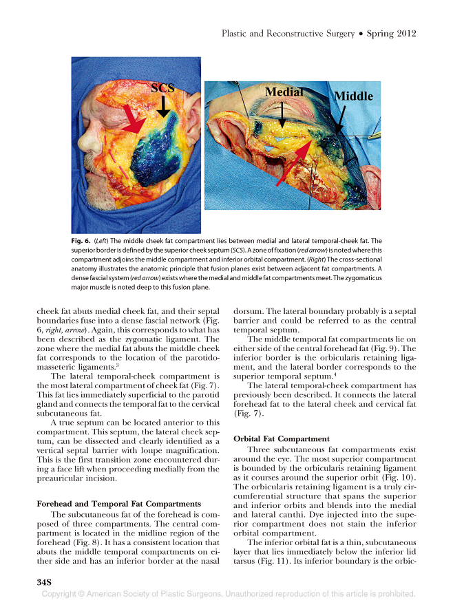 The Fat Compartments of the Face Anatomy and Clinical Implications for ...