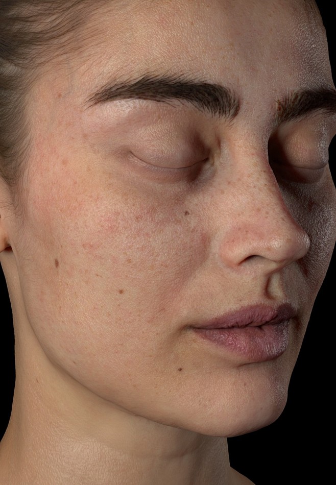 skin test