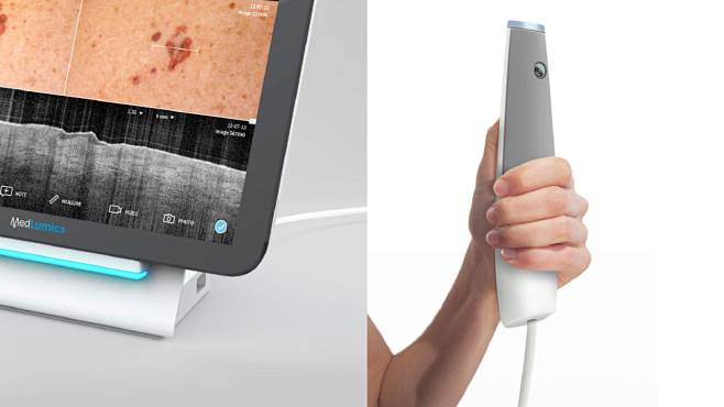 NITID for MedLumics — FLUID Design : MedLumics, medical imaging company ...