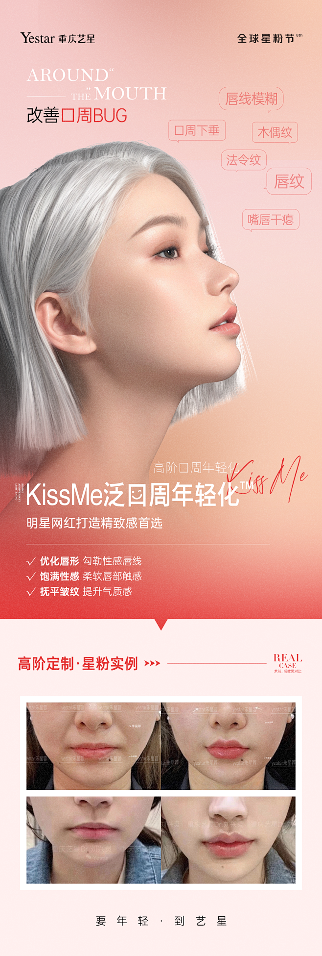 KissMe泛口周年轻化