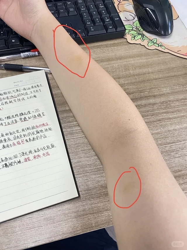 女生右胳膊 - 小红书搜索-花瓣网