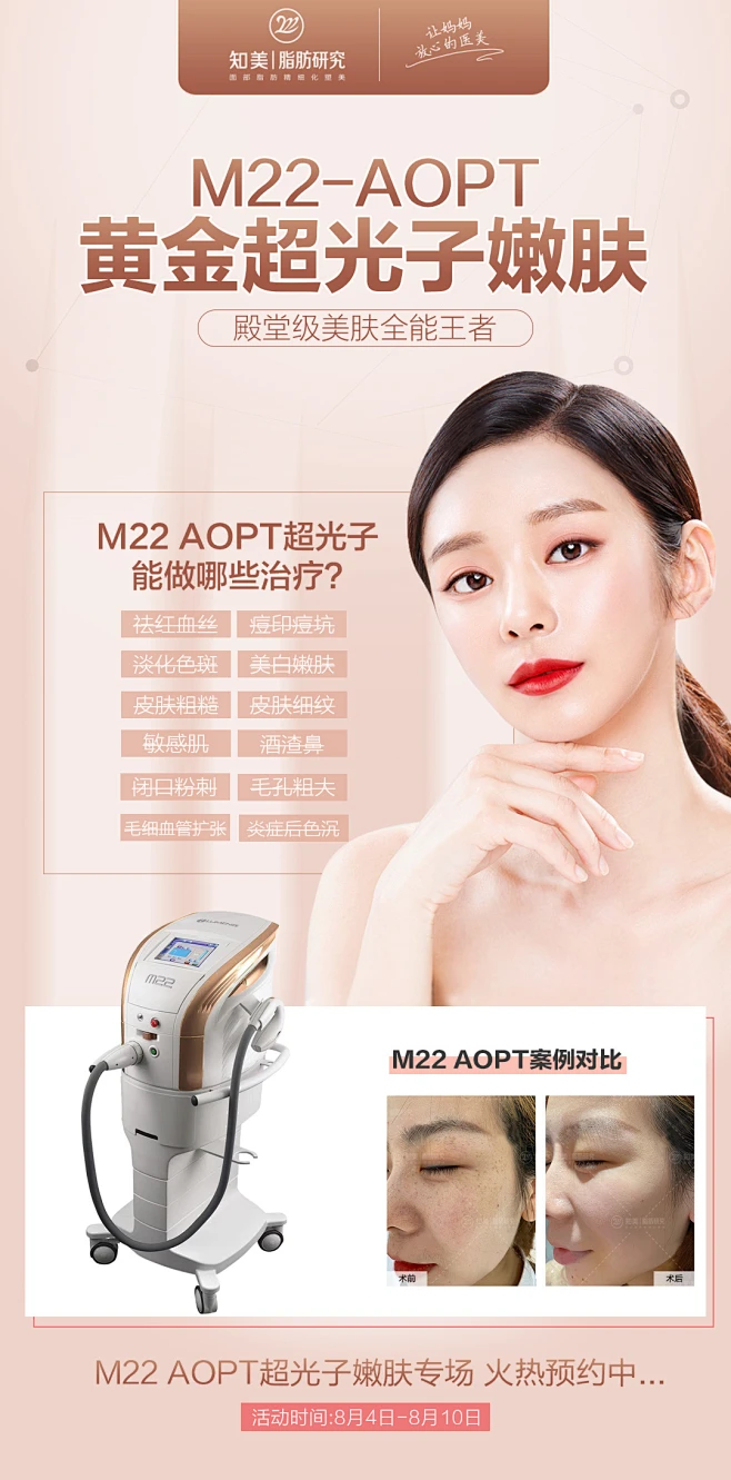 M22-AOPT微信-副本333-花瓣网