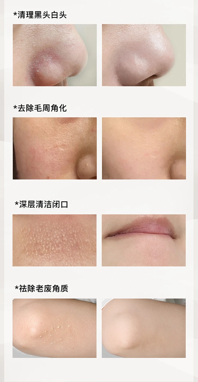 [官方旗舰]RNW去角质乳面部女深沉清洁毛孔脸部死皮全身男去黑头-tmall.hk天猫国际-花瓣网