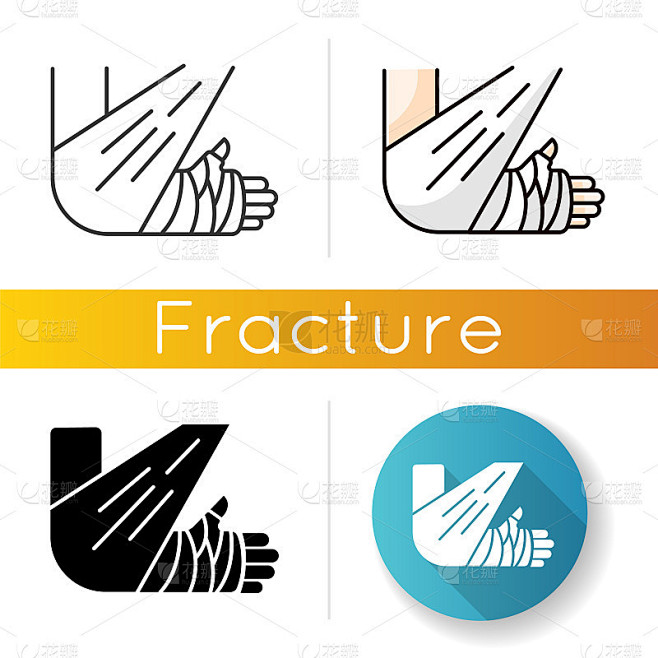 骨折图标。受伤的手臂上缠着石膏。受伤的肢体包扎着。肘部受伤。创伤的治疗。医疗保健。医疗条件。线性黑色