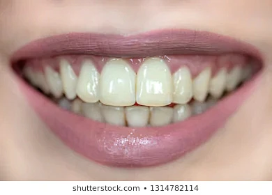 Woman painted pink lips. Beauty lips make-up. Perfect skin, full lips. -花瓣网