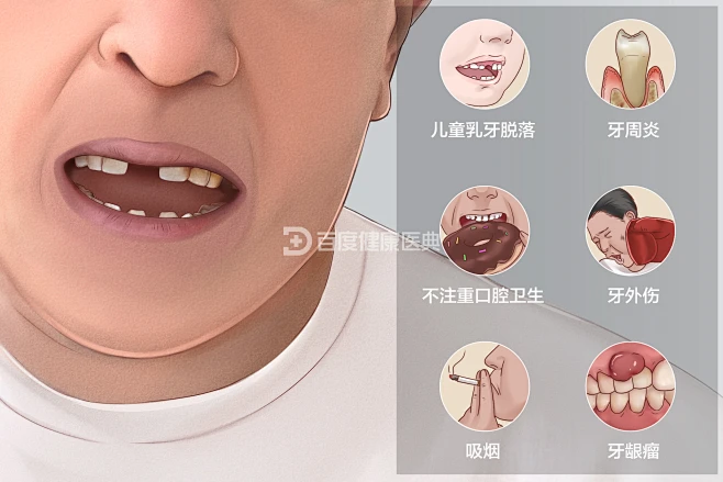 牙齿松动-花瓣网