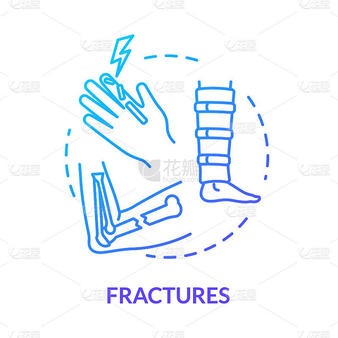 骨折，骨脆性概念图标。骨科、外伤、人体骨骼损伤、钙质缺乏症细线说明。矢量隔离轮廓RGB彩色绘图。可编